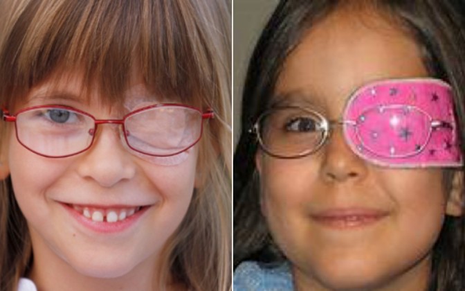 An Insight into Amblyopia – EyeSite